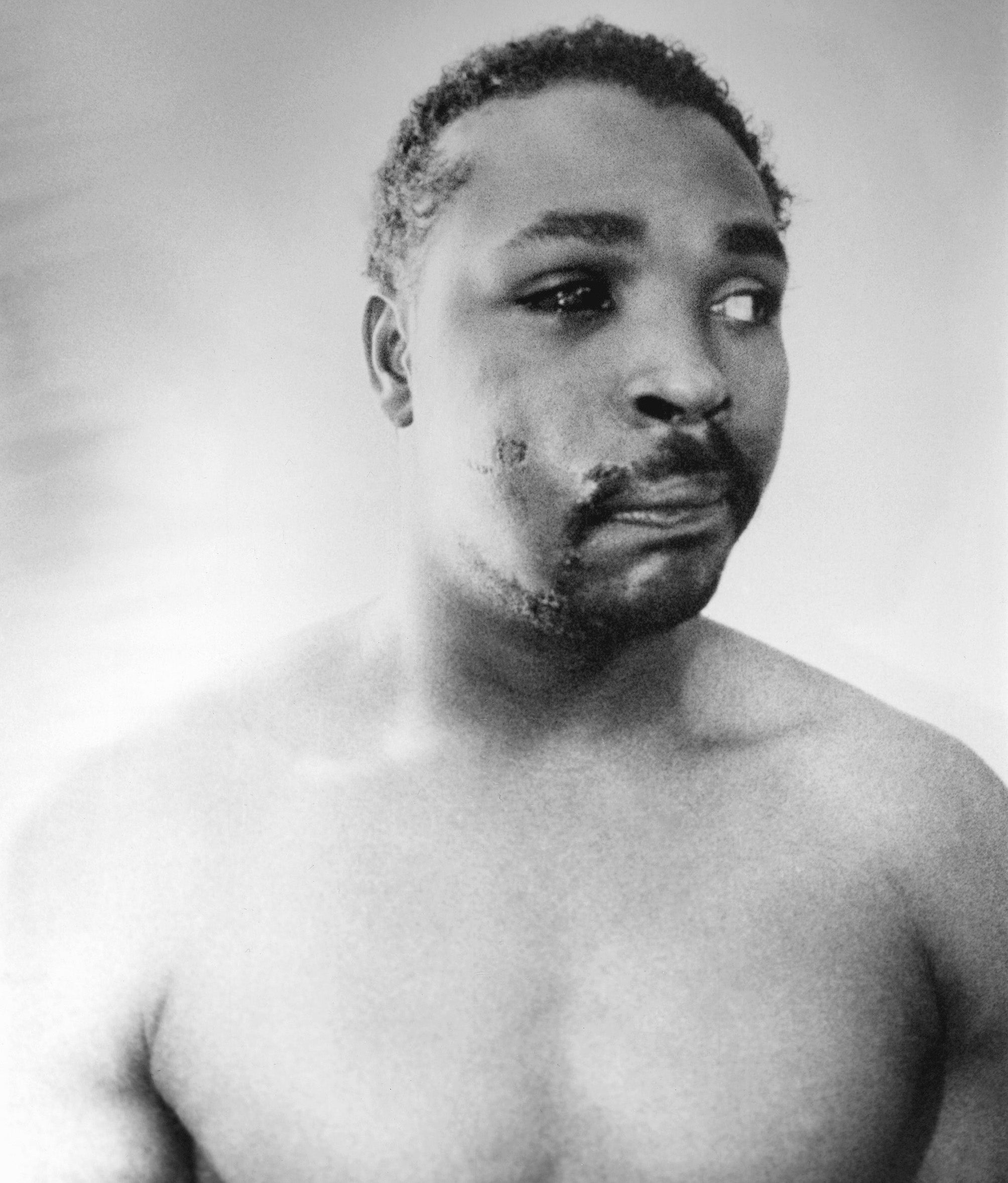 Rodney King Beating Today In History March 3 Pictures CBS News rodney-king-beating-today-in-history-march-3-pictures-cbs-news