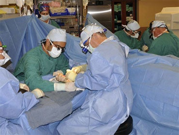 Burn Victim Gets 2 New Hands in 18-Hour Surgery - CBS News