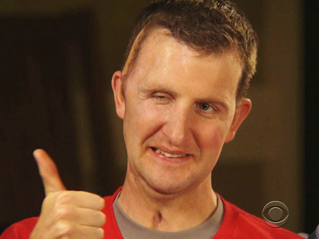 Hero saluted at State of the Union faces toughest battle yet - CBS News