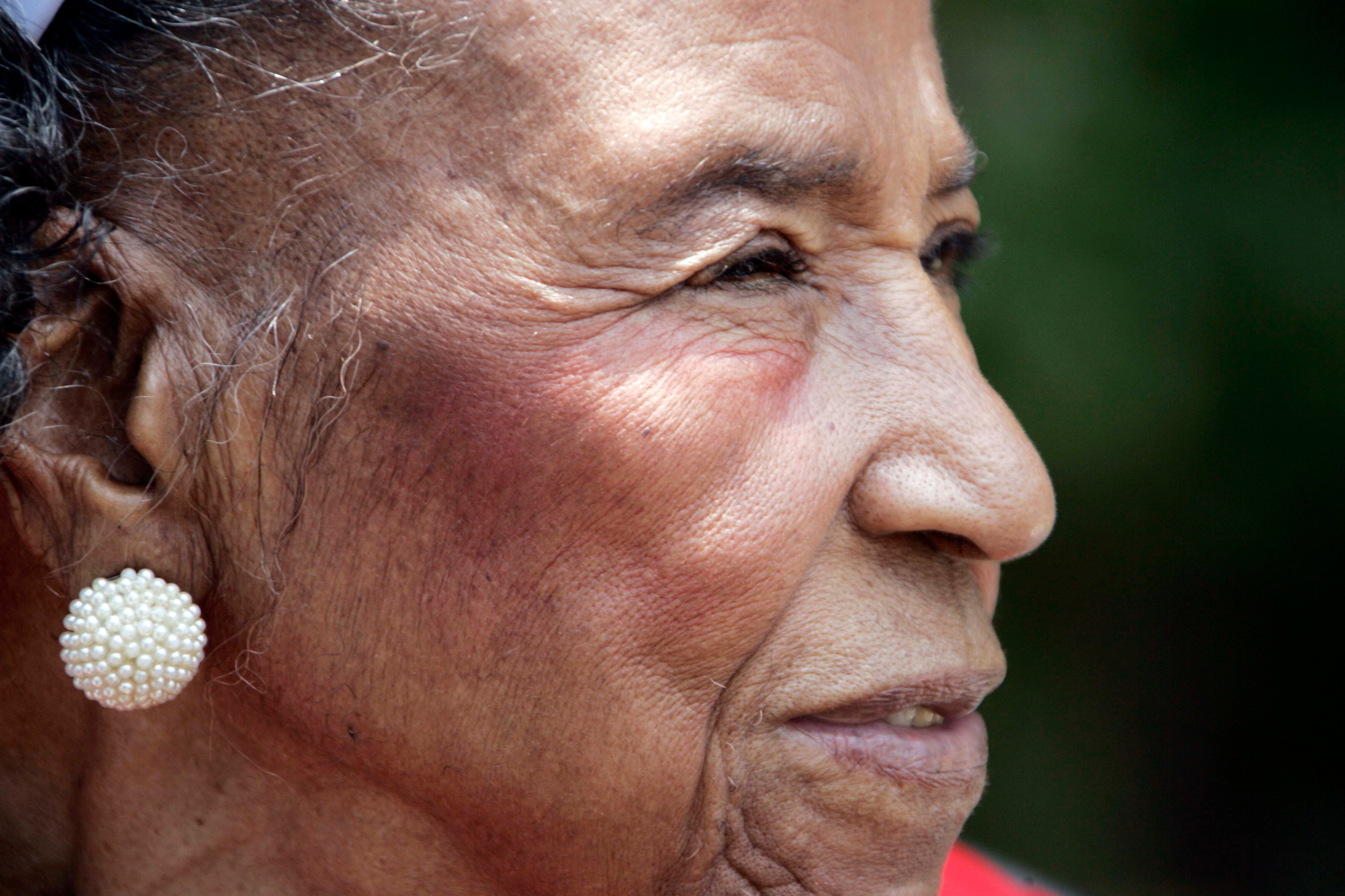 Civil rights activist Amelia Boynton Robinson dies at 104 - CBS News