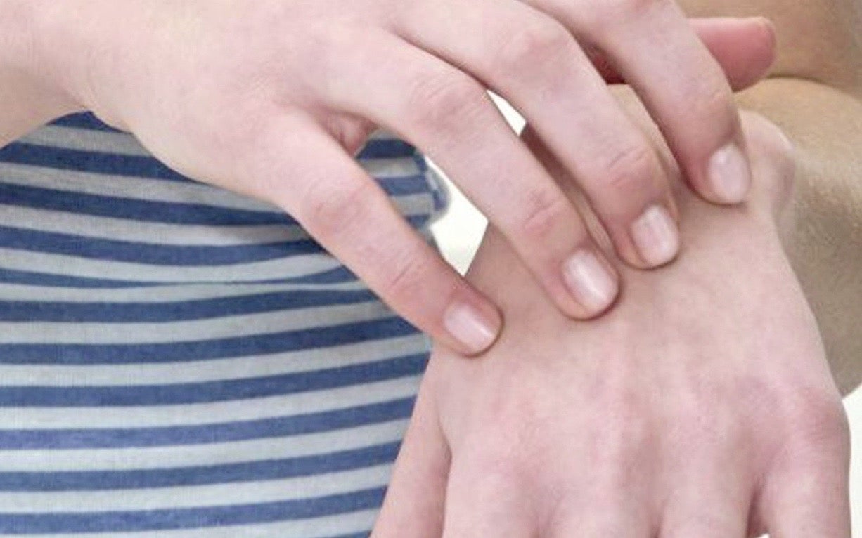 En Tiempo Real: La sensación de rascarse, tan parecida a la relación ...