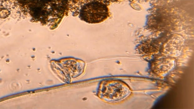 Almanac: The discovery of bacteria - CBS News