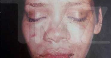 Photo May Show Rihanna After Beating - CBS News