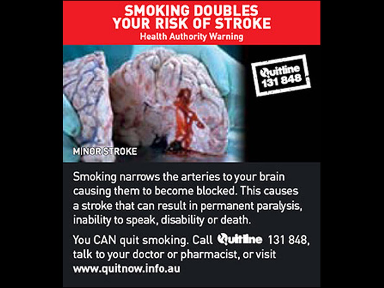 Australia's graphic tobacco warning labels - Photo 1 - CBS News