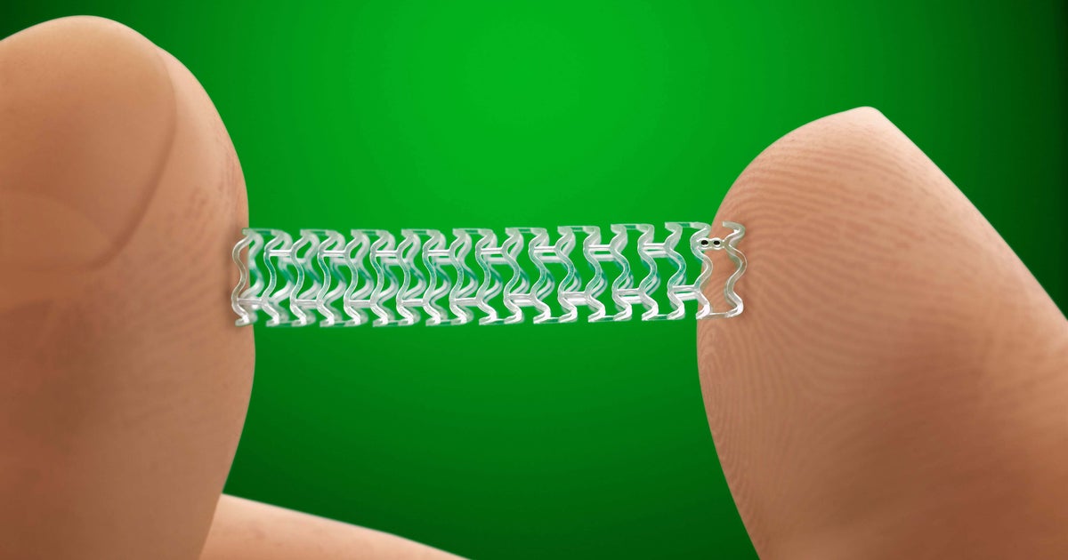 FDA approves first dissolving heart stent for U.S. patients - CBS News