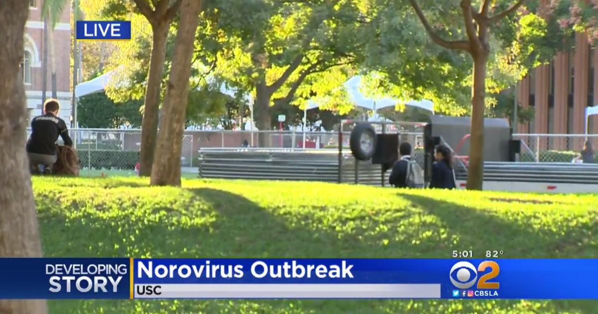 Norovirus Outbreak At USC Sickens At Least 100 Students CBS News