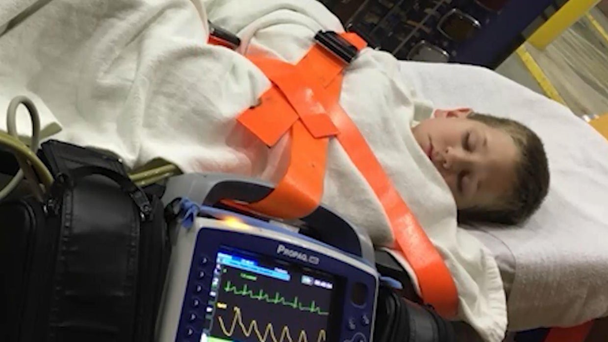 Fireworks display gone wrong nearly cost firefighter his vision - CBS News