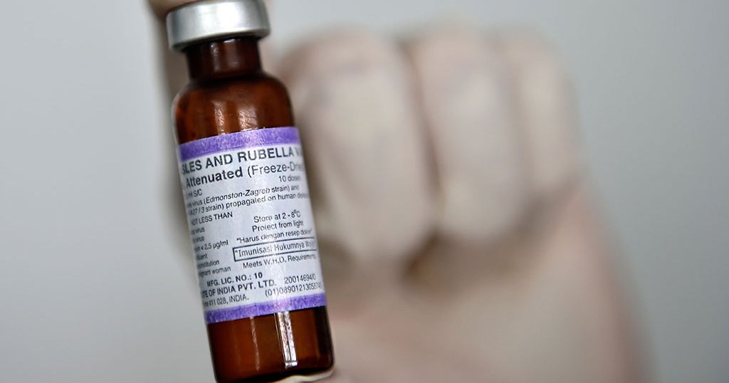 Possible Mumps Exposure At Urgent Care Center In Rye - CBS New York