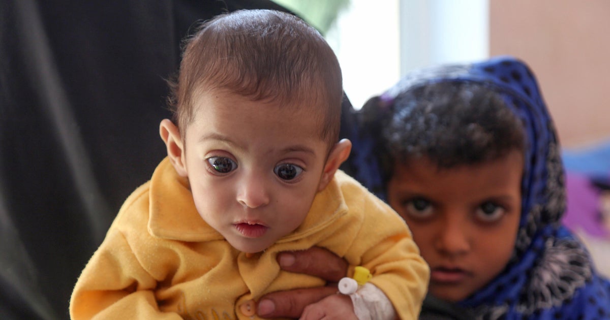 Yemen war: "Twenty million Yemenis are hungry," U.N. emergency relief ...