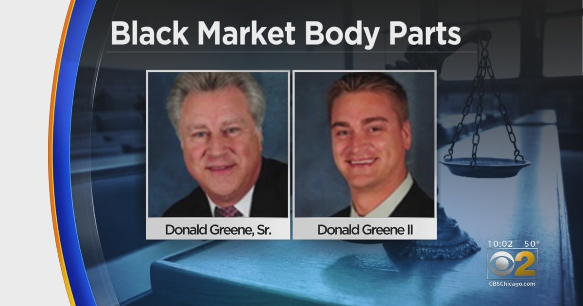 Father And Son Charged With Selling Diseased Body Parts In Alleged ...
