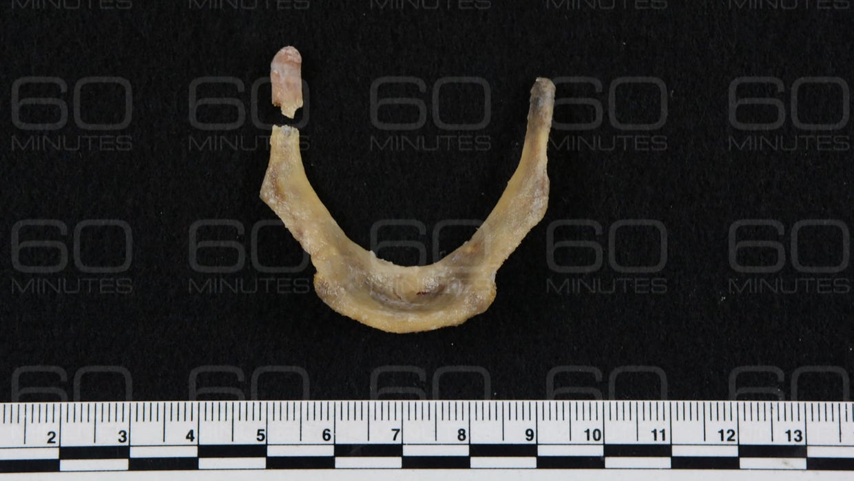 Jeffrey Epstein's autopsy: A closer look — "60 Minutes" - CBS News